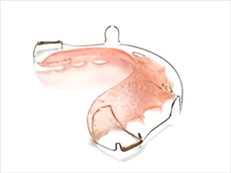 Retention | Noble McClintock Orthodontics | San Angelo TX